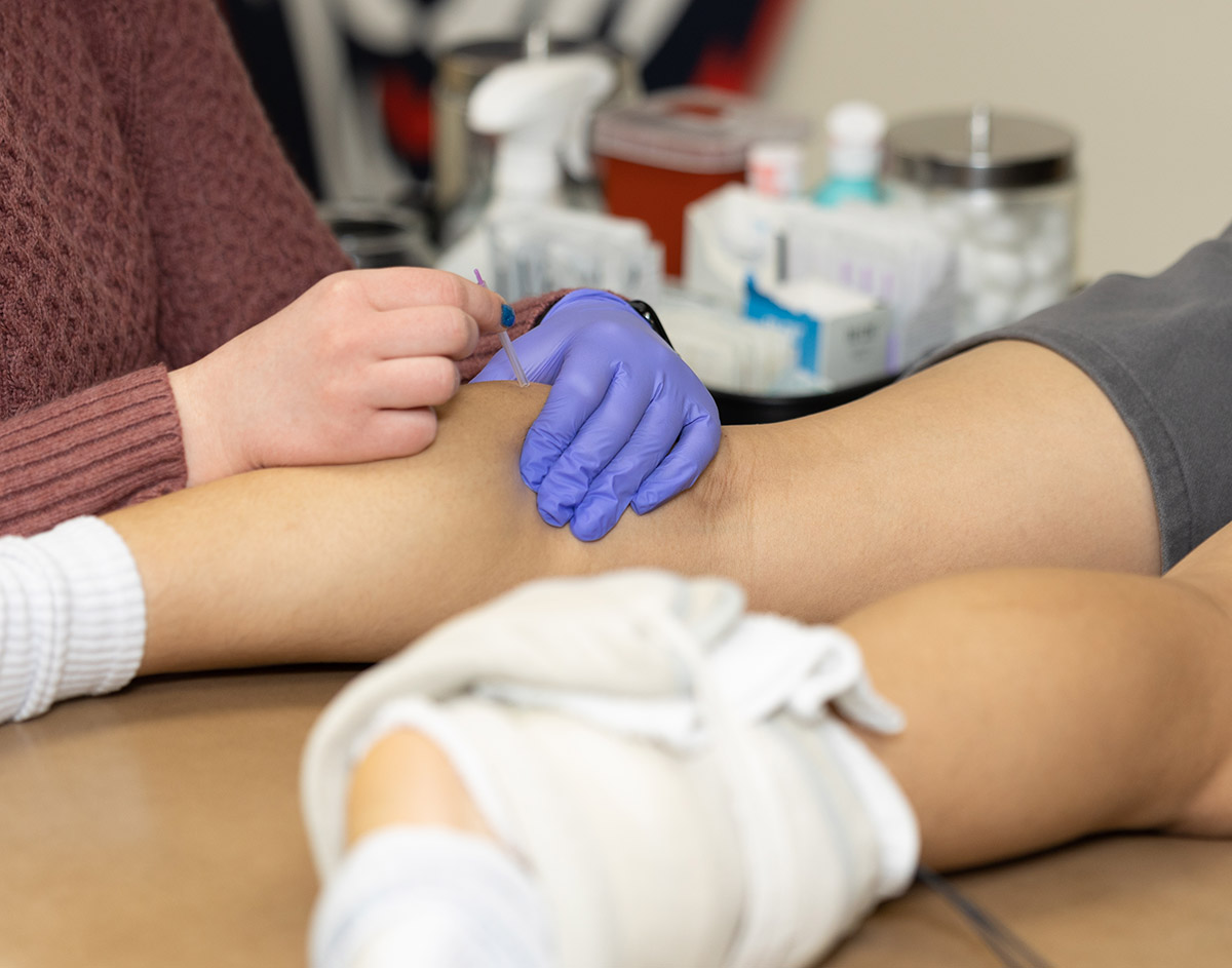 Conditions-We-Treat-with-Dry-Needling – Magna Physical Therapy & Sports ...